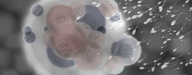 Surgical Sperm Retrieval – Go IVF Surrogacy